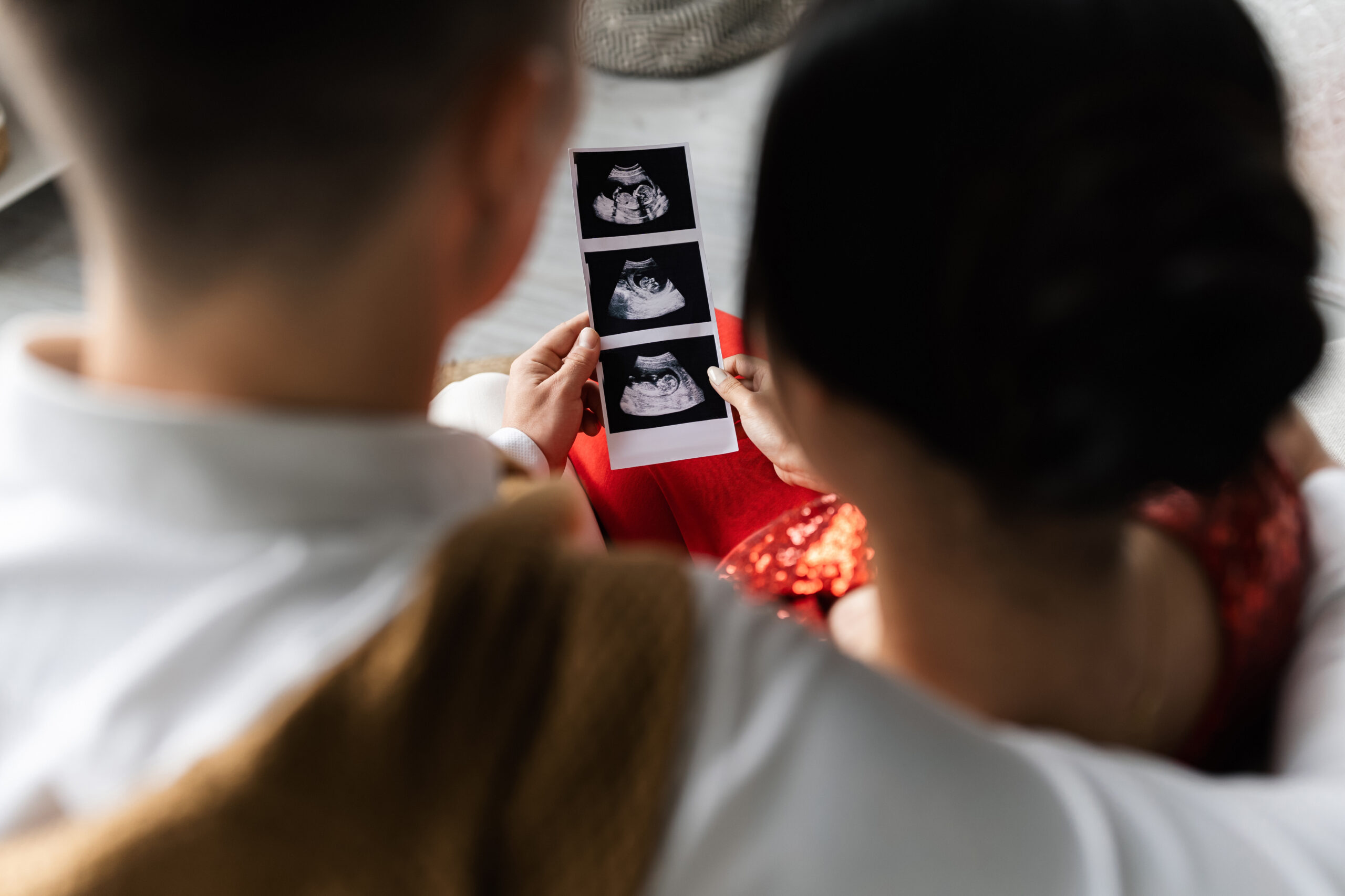 Preparing for Your First Elective Ultrasound: A Comprehensive Guide