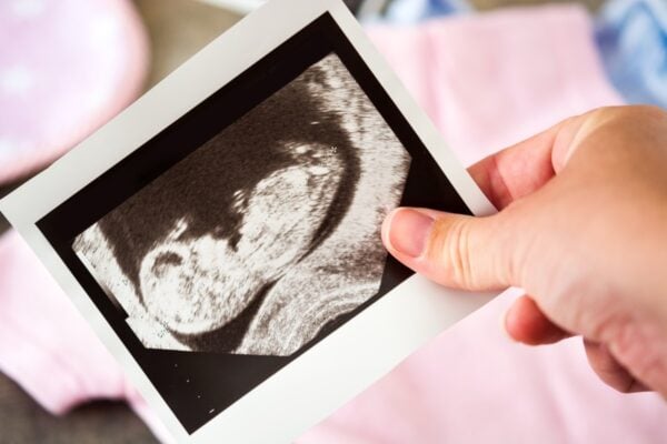 Ultrasound Machine Trade-In Programs: What Studio Owners Need to Know ...